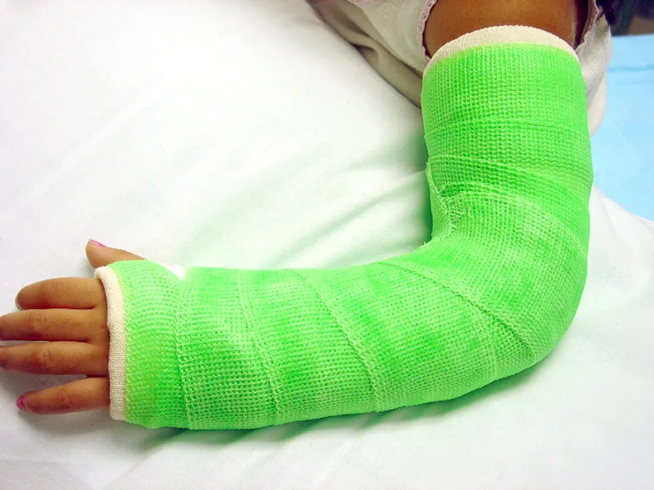 Figure-of-Eight Clavicle Splint: Expert Orthopedic Guide - عيادة أ.د ...