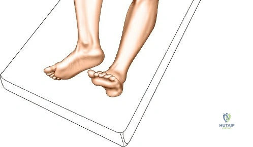 Proximal Tibial Posteromedial Approach: Expert Guide | Guide Chapter